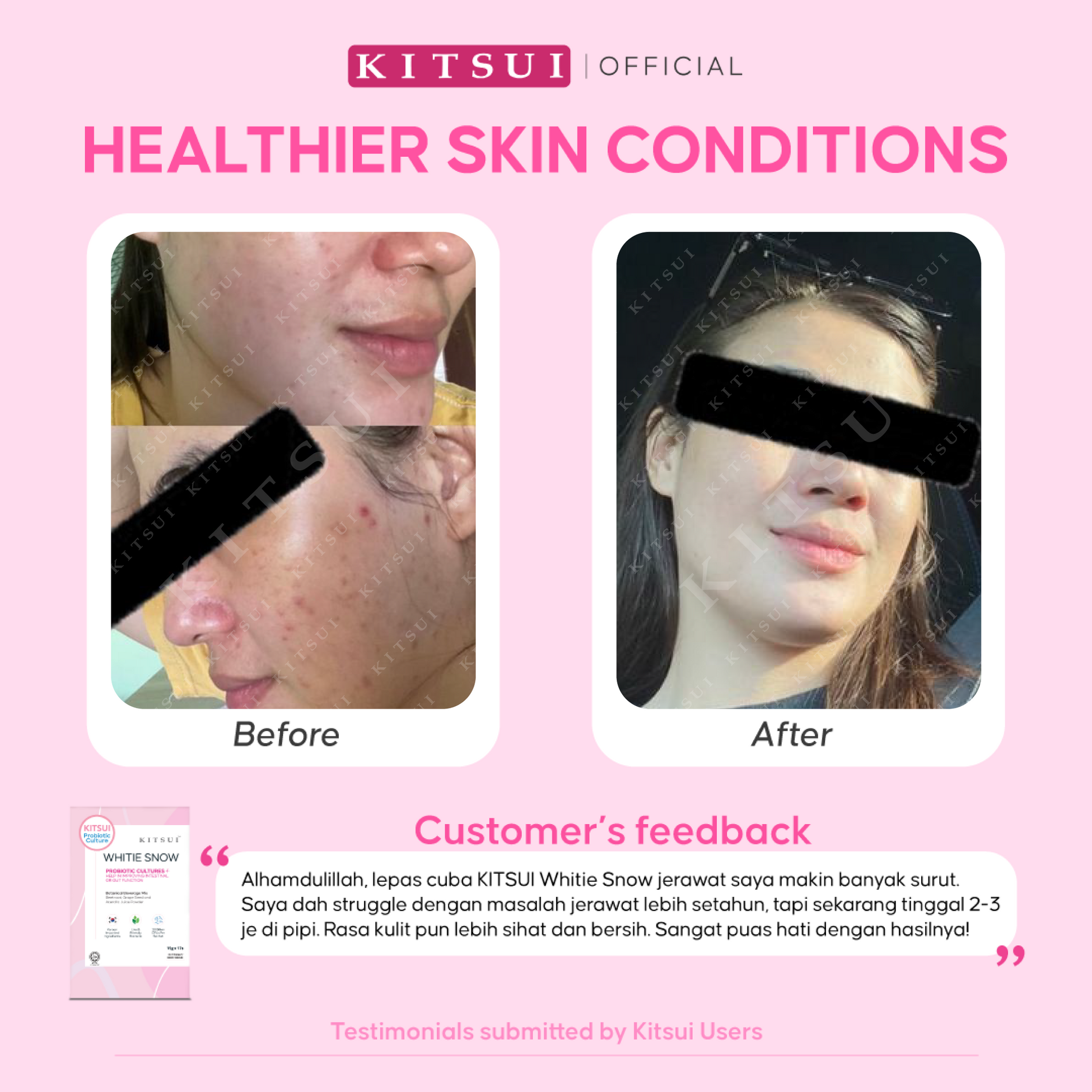 KITSUI Whitie Snow 17's x 15g | Skin | Gut Health | Brightening ...